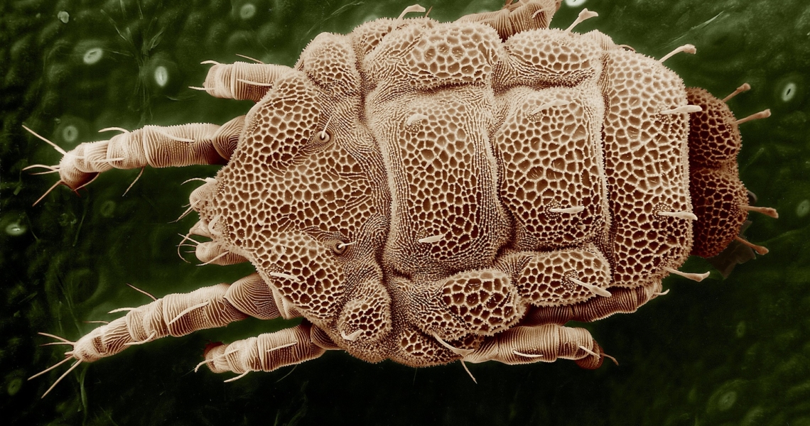 Milben bei Menschen Archive - Milben-Profi.de